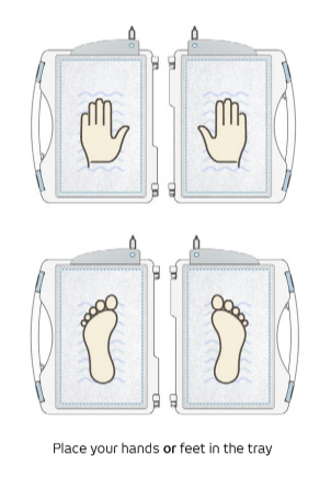 How-To: Treatment for Hands & Feet – Support | Dermadry